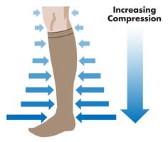 Comment fonctionnent les bas de compression graduée (BCG)? | Cetac
